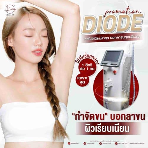 Diode Laser บอกลาปัญหาขน เพิ่มความเรียบเนียน - B.MEE Clinic